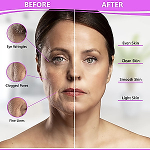 Dermal-Tech Light Therapy Face Mask Rejuvenation FDA Cleared PDT LED Facial Red Light Therapy Face & Neck Lift & Tightening Machine, Anti Aging, Dark Spot Remover Device (Flexible Silicom)