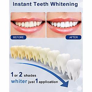 AZ Smile Teeth Whitening Pen (3 Pens), 30+ Treatments for teeth whitening No Sensitive Teeth Whitening Gel Travel-Friendly Teeth Whitener, Helps to Remove Stains from Soft Drink, Smoking, Coffee, Wine