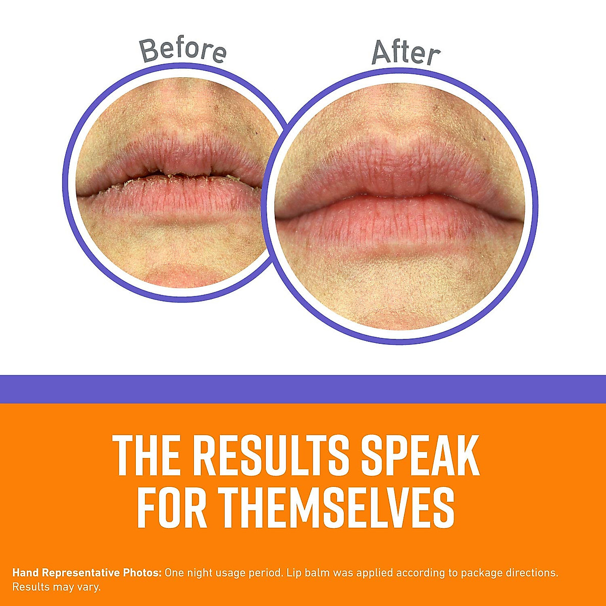 O'Keeffe's Lip Repair Night Treatment Lip Balm, 0.25 Ounce Jar, (Pack of 1)