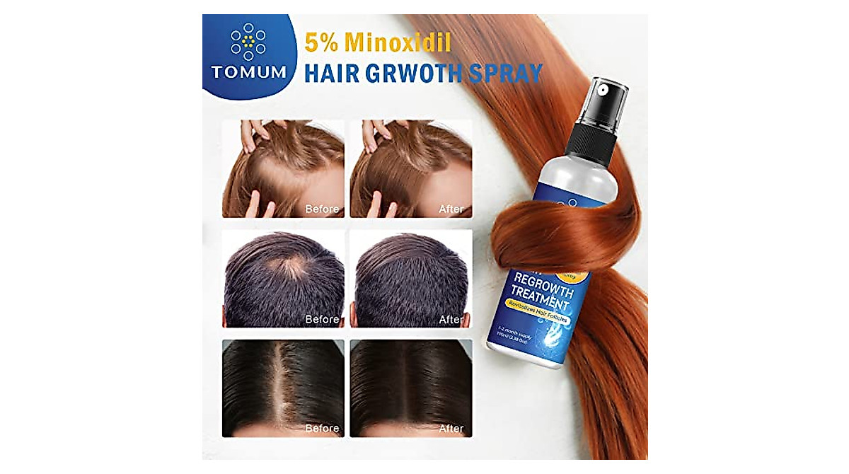5% Minoxidil Hair Growth Spray for Men & Women - Thicker Hair