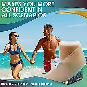 (1.6" x 150" Roll-3.8M) Professional Silicone Scar Sheets - Scars Removal Treatment - Reusable Silicone Scar Strips Type for Keloid, C-Section, Surgery, Burn, Acne et