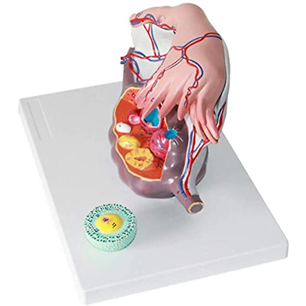 DEAVER Medical Models, Uterine Anatomy Model Ovarian Enlargement Model Skin and Genitourinary System Anatomical Medical Training Aid