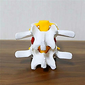 Global-Dental Anatomical Herniated Lumbar Vertebrae Disc Prolapse Model Human Anatomy Model White
