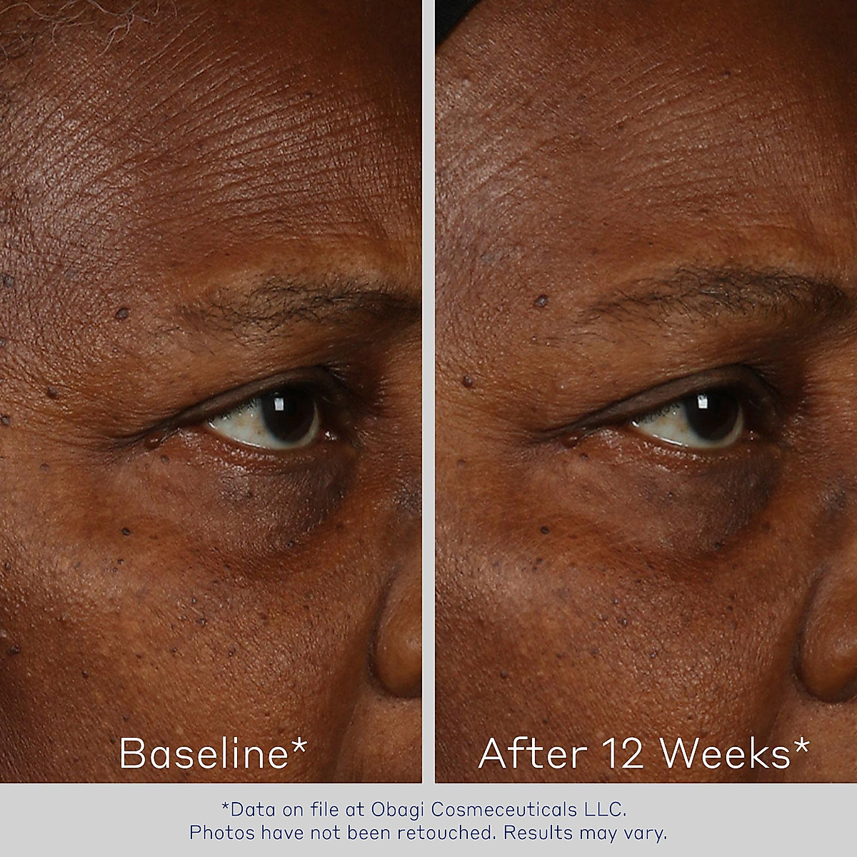 Obagi ELASTIderm Facial Serum – Firming Face Serum with Patented Bi-Mineral Contour Complex Clinically Proven to Target Signs Of Skin Aging – 1 oz