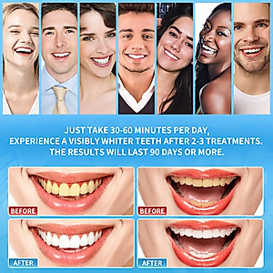 Teeth Whitening Strips - DeepKlean White Strips for Removing Years Stains, Enamel Safe, 3 Days Express Result, 28 Teeth Whitener Strips for Teeth Sensitive 14 Treatments Peppermint Non-Slip Strips