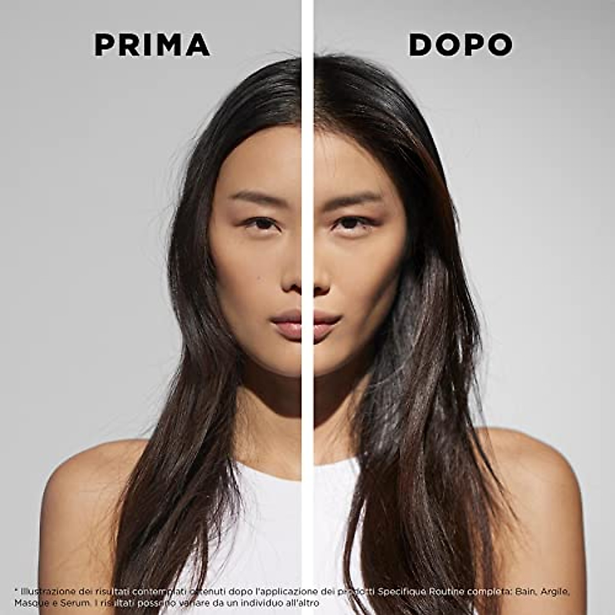 KERASTASE Specifique Bain Vital Dermo-Calm, 8.5 Fl Oz