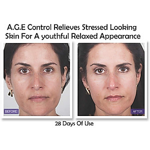 AGE Control Dual Treatment Anti Glycation Serum: Look 8-10 Years Younger In 60 Days. Reduce Discoloration & Dark Spots, Lifting, Firming, Brightening, Hydrating, Anti-Wrinkle, Non Greasy