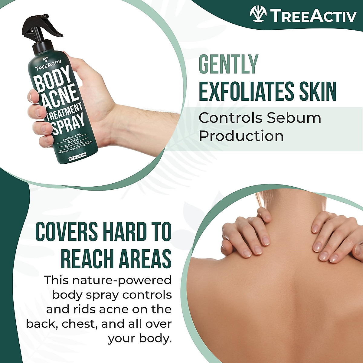 TreeActiv Body Acne Treatment Spray, 8 fl oz, 2% Salicylic Acid Spray for Body, Back Acne Treatment Spray with Tea Tree Oil and Aloe Vera, Gentle Back Acne Spray that Clears Body Acne, 2000+ Uses