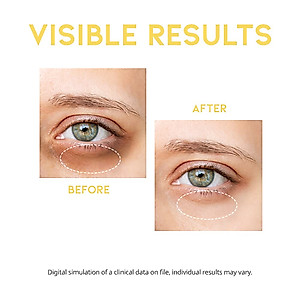 Dark Circle Remover Eye Serum, Eye Bags Treatment for Men and Women, Vitamin C, Niacinamide, Ceramide, Vegan Under Eye Treatment 30g