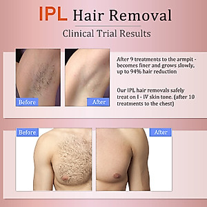 Permanent Hair Removal, MiSMON IPL Hair Removal for Women/Men, at-Home Hair Removal Machine for Bikini/Legs/Underarm/Arm/Body with Skin Color Sensor - Safe and Effective Technology