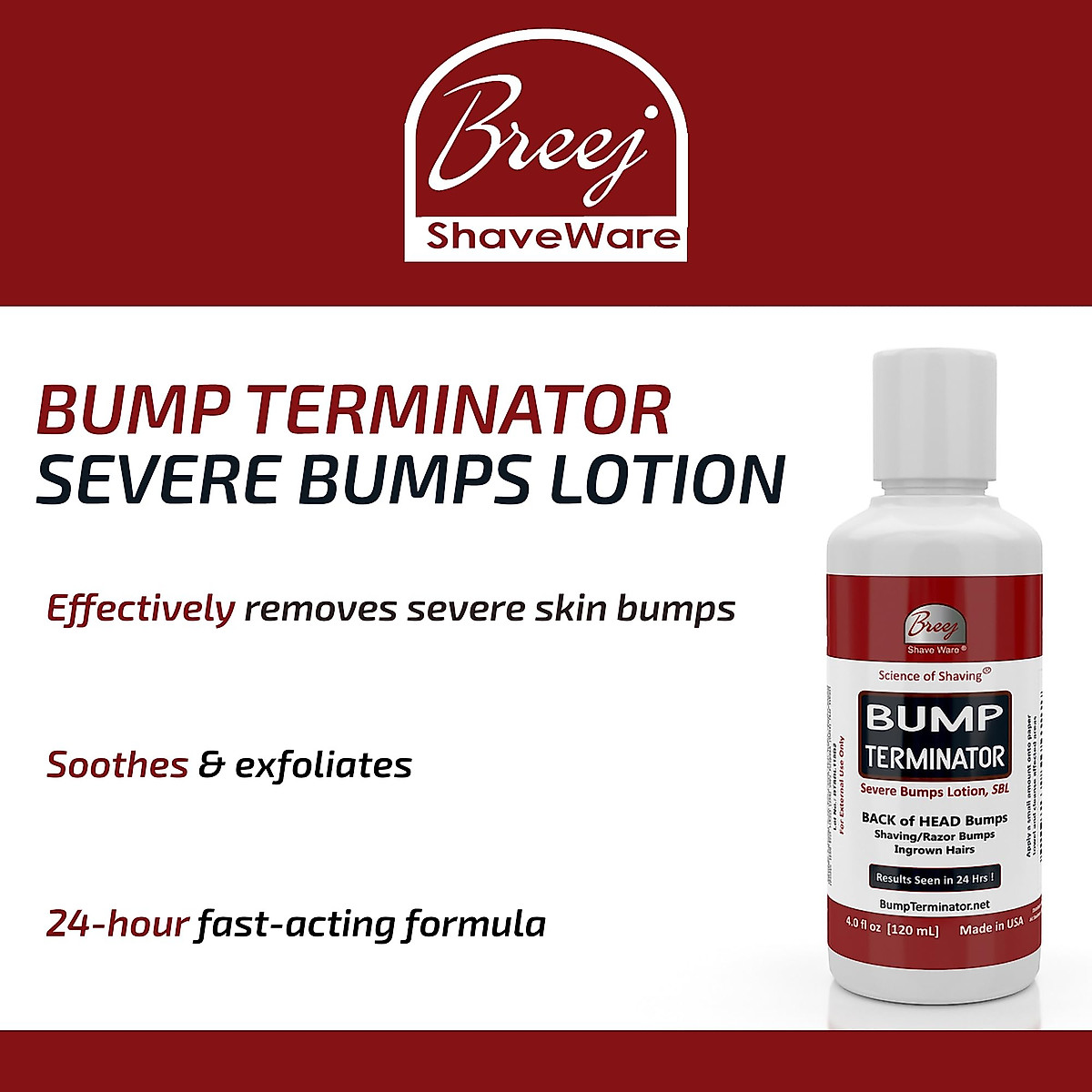 Bump Terminator Severe Bumps Lotion (4oz)