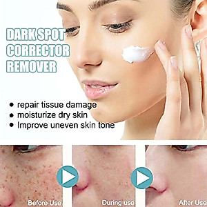 3 Pack Dark Spot Cream For Face,Dark Spot Remover For Melasma,Skin Spot Remover Cream,Freckle Remover Cream,Age Spot Remover,Dark Spot Cream For Women & Men (2 Pack)