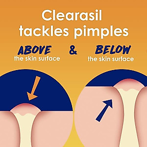 Clearasil Ultra 5in1 Exfoliating Wash, 6.78 oz. (Pack of 3)