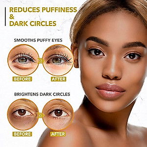 Arvesa Under Eye Patches - Eye Mask For Puffy Eyes And Dark Circles Reduce Wrinkles & Bags - Skin Treatment Pads Anti Aging Moisturizer Mask For Women Gift Eye Gel Pads