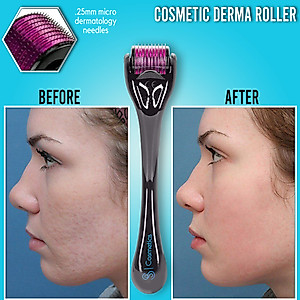 SB Cosmetics- Derma Roller-Best Premium Beard Face Scalp & Body Cosmetic Micro Needle Skin Care Beauty System .25mm 540 Titanium Reusable