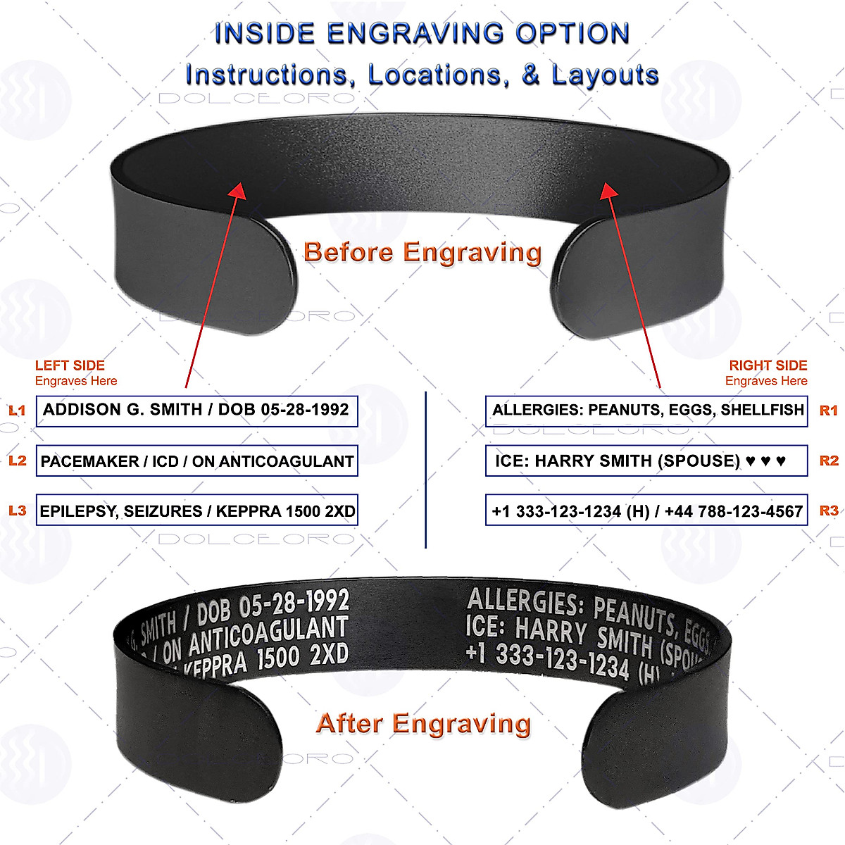 Medical Alert ID Bracelet Cuff 14mm Wide, 316L Stainless Steel - Customize and Personalize 8 Lines with Your Conditions
