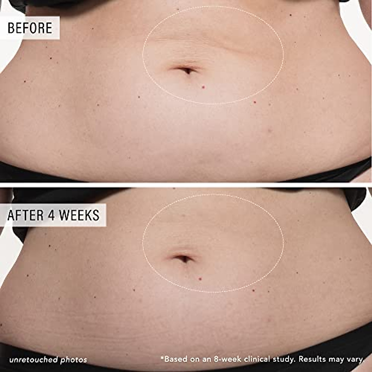 JLO BEAUTY Firm + Flaunt Targeted Booty Balm | Firms, Hydrates, Improves Skin Elasticity & Helps To Fade the Appearance of Stretch Marks | 4.2 Ounce