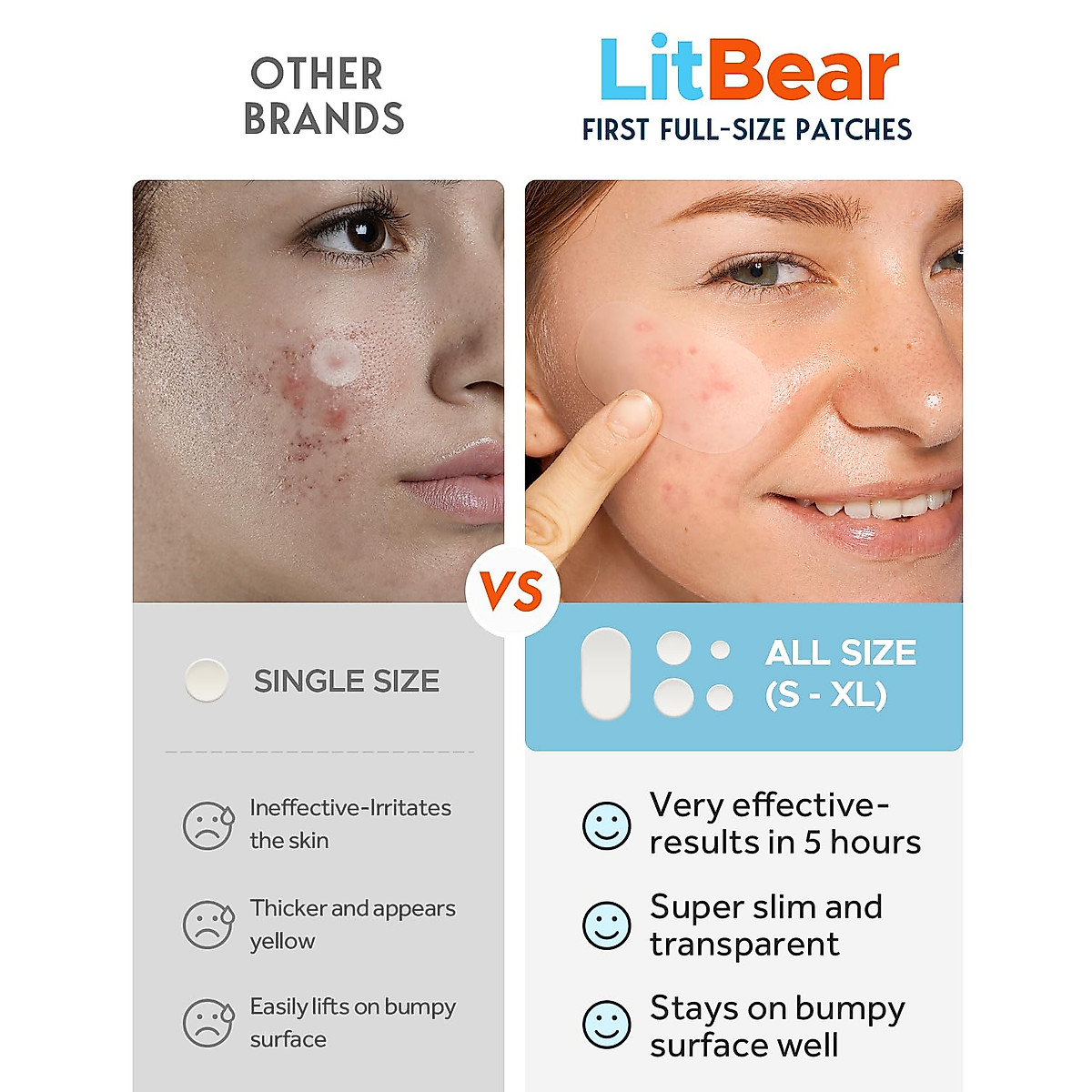 LitBear Large Acne Pimple Patches, 5 Sizes 80 Patches for Large Breakouts, Acne Patches for Face, Chin or Body, Acne Spot Patch with Tea Tree & Calendula Oil, Hydrocolloid Bandages for Acne Skin