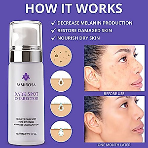 Dark Spot Remover for Face - Dark Spot Corrector Serum for Sun Spot Brown Spots Stubborn Spots-Freckle Remover - Melasma Hyperpigmentation Treatment Formulated with 4-Butylresorcinol, Kojic Acid and Hyaluronic acid- 50 ml
