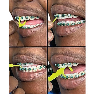 Flosser for Braces| Ortho Floss| 300 Count Bag| Pack of 6 Bonus 4 Interdental Brush| Floss Dental Pick Fits Between Brace Wire and Teeth| Quick and Easy Braces Floss