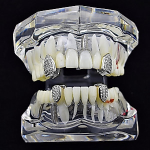 Single Cap Tooth Set CZ Cubic Zirconia Silver Tone 2 Top Teeth Plus Two Bottom Iced Canine Cap Grills