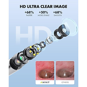 Anykit Wireless Otoscope Ear Camera with Dual View, 3.9mm 720PHD WiFi Ear Scope with Ear Wax Removal Tool for Kids and Adults & Pets, Compatible with Android and iPhone