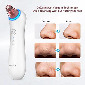 Blackhead Remover Pore Vacuum Extractor-2025 Upgrade GERY Blackhead Cleaner Electric Comedone Acne Extractor Kit Facial and Nose Peel Whitehead Black Head Removal Tool,Red&Blue Light, and 4 Porbes