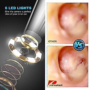 Pancellent Digital Otoscope Camera with Light, Ear Camera, Video Ear Scope with Ear Wax Removal Tools, Ear Endoscope Cleaner, Compatible with iPhone, iPad, Android Smart Phone (Basic Edition Black)