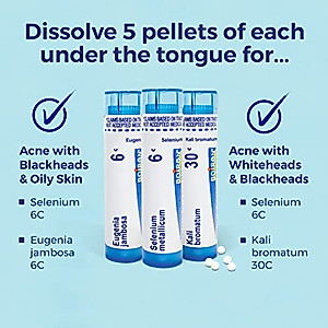 Boiron Acne Relief Kit for Blackheads, Oily Skins, Whiteheads on The Face and Body - 3 Count (240 Pellets)