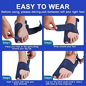 Toe Corrector Toe Separator Bunion Splint 【2024 Updated】 Hallux Valgus Bunion Big Toes Corrector Set Bunion Brace Bunion Exercise Strap Orthopedic Kit Bunion Pain Relief (free, Blue)
