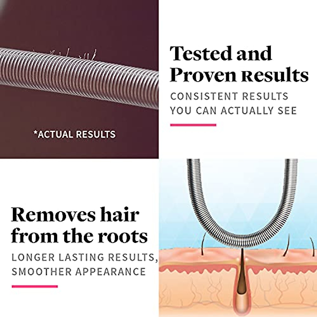 R.E.M Spring Facial Hair Remover - The Original Hair Removal Spring [Design Patent]. Removes Hair from Upper Lip, Chin, Cheeks and Neck. 100% Stainless Steel