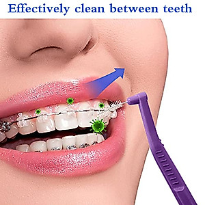 25 Pcs Interdental Angle Brushes,Reusable Dental Cleaners,Oral Dental Hygiene Brush,Dental Toothpick Floss for Braces,Tooth Cleaning Tool (Multi-Colored)