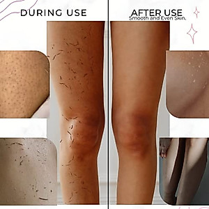 Asymi Deep Exfoliating Glove - Reusable Exfoliating Mitt for Dead Skin Removal (Keratosis Pilaris Strawberry Legs Ecologic body care) Vegan Body Scrub SPA body Treatment (Grey Cloudy), 1.0 Count