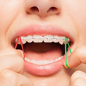 JMU Orthodontic Elastics 1/4 Heavy, 500 Pack Intraoral Elastic Bands Non-Latex Neon Dental Rubber Bands Made in USA