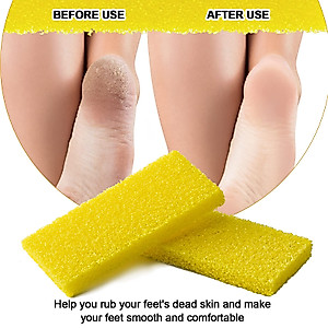 140 Pcs Disposable Foot Pumice Stone Foot Scrubber Sponge Pads for Feet Hard Skin Heels Callus Remover Pedicure Foot Pumice Exfoliator Sponge Coarse Dead Skin Remover, Yellow