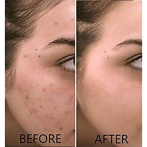 Vitamin C Serum 20% Pure L-Ascorbic Acid, Ferulic Acid, Vitamin E and Hyaluronic Acid for Face and Eyes Natural Anti Aging Anti Wrinkle 1oz. by Dr. Brenner (1 oz)