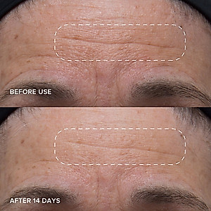 Alpyn PlantGenius Melt Moisturizer | Weightless Rich Cream Targeting Dry, Dehydrated Skin with Lasting Hydration and a Velvety, Makeup-Ready Finish | 1.7 oz / 50 ml