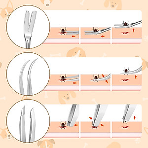 Rypet Tick Remover Tool Set - Stainless Steel Tick Remover Kit for Cats Dogs and Humans(Pack of 3)