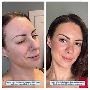 ZENMED Gentle Facial Cleanser 6 oz for Women and Men - All-in-One Cleanser Face Wash | Hydrating Cleanser & Gel Cleanser for Sensitive Skin | Natural, Organic Facial Wash - USA Made