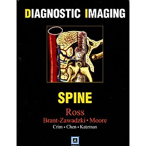 Diagnostic Imaging: Spine
