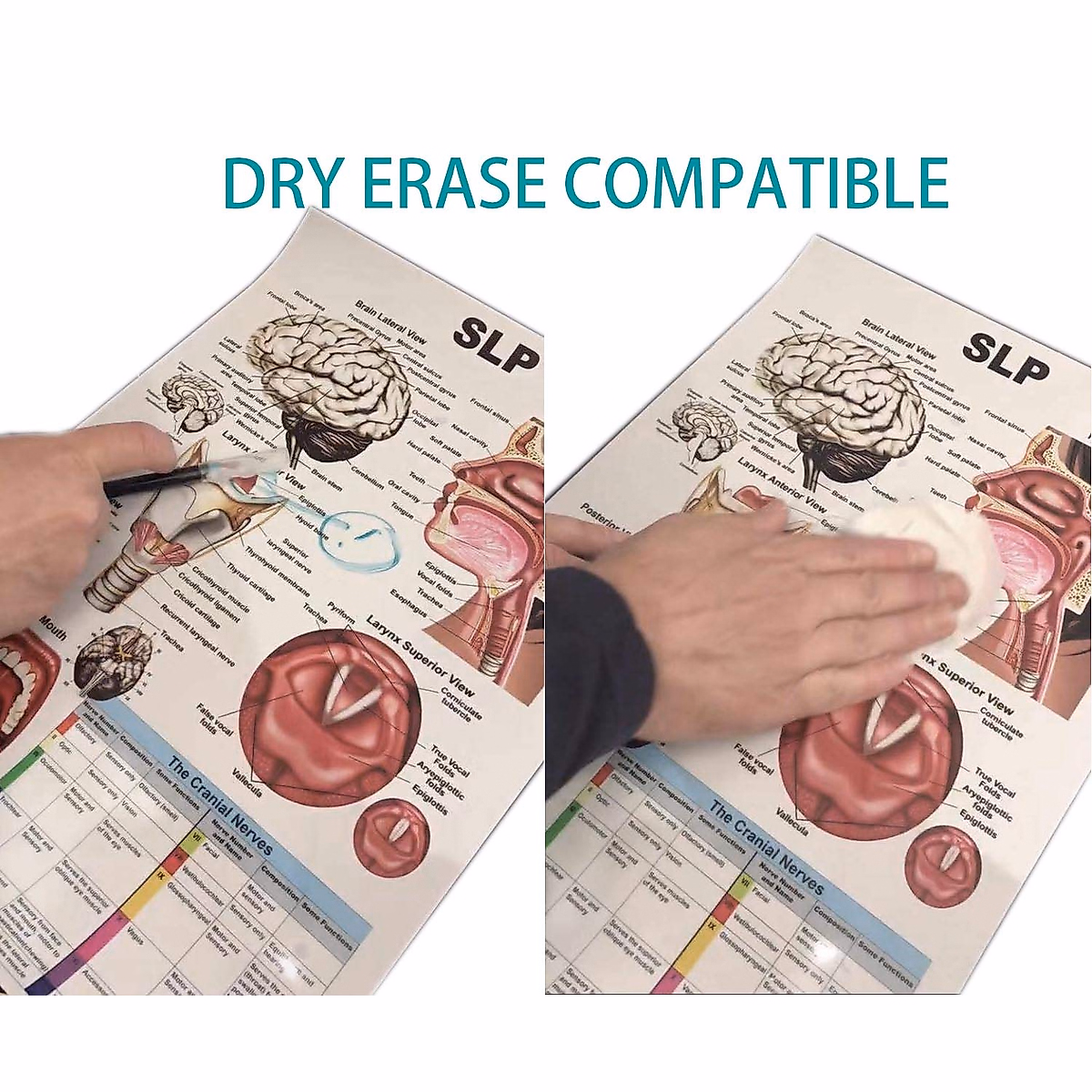 Foot and Ankle, Hand and Wrist, Shoulder and Elbow, Hip and Knee Anatomical Poster Set, size 12Wx17T