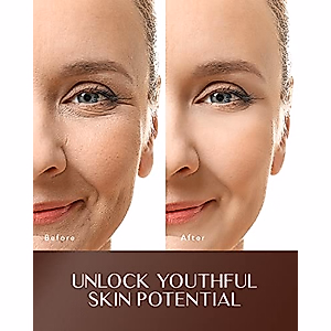 EnaSkin Retinol Wrinkle Cream for Face with Hyaluronic Acid, Deluxe Anti Aging Moisturizer Reduce Wrinkles, Fine Lines, Day and Night Retinol and Collagen Moisturizer Face Cream, Stocking Stuffer, 1.7 Fl. Oz