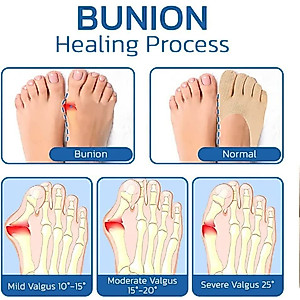 LELISKA 6Pairs Projoint AntiBunions Health Sock,Split Toe Bunion Socks Five Finger Socks,Orthopedic Toe Compression Socks (Mens-B Set)