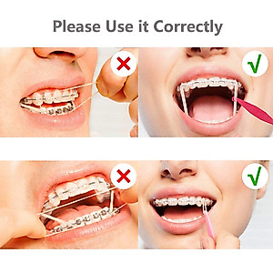 500 Pcs DentalSmile Amber Elastic Latex Braces 3/16 Orthodontics Rubber Bands Heavy 6.5oz Dental Latex Bands Dentist Great for Dreadlocks, Braids, Top Knots + 5 Free Placers