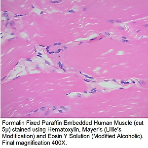 Eosin Y Solution (Modified Alcoholic), 1000ml