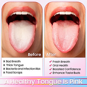 Tongue Scraper for Adults, Tongue Scraper Stainless Steel, Tongue Cleaning Fight Bad Breath Treatment for Oral Care, Free Breath Tongue Brush Travel Friendly BPA Free (2 Packs)