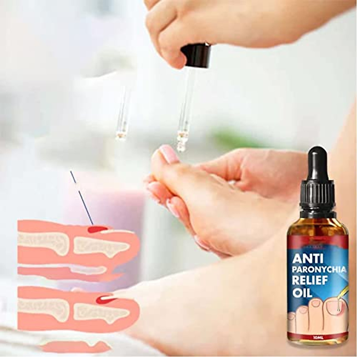2PCS German Toenailplus Anti Paronychia Relief Oil, Anti Paronychia Relief Oil, Toe and Fingernail Repair for Damaged Discolored Thick Nails