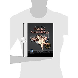 Diagnostic Imaging: Pediatric Neuroradiology