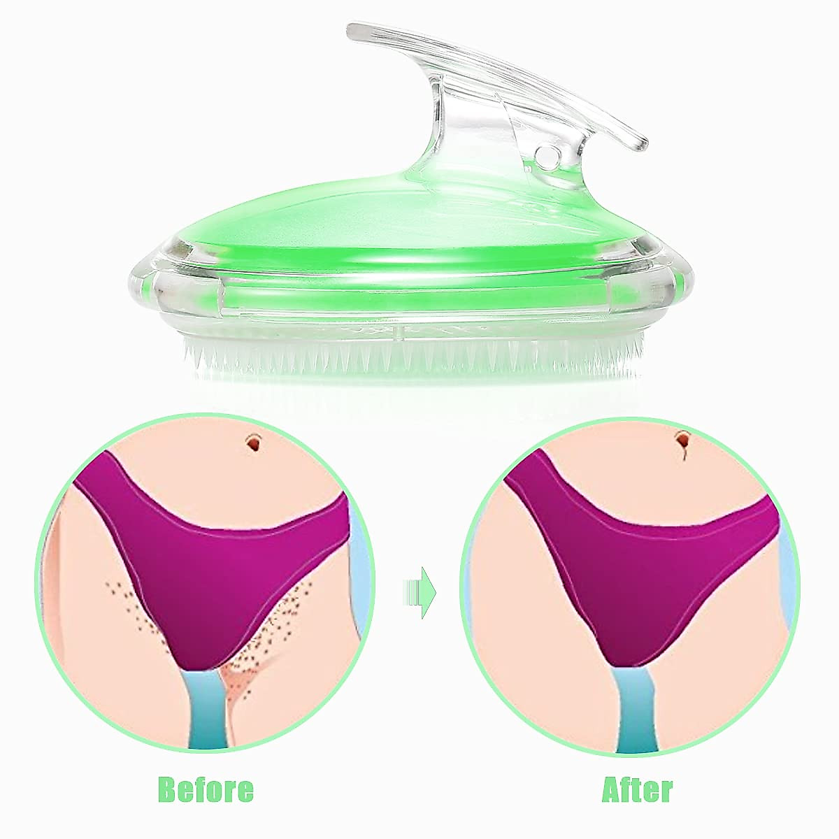 TailaiMei Exfoliating Brush for Ingrown Hair Treatment - To Treat and Prevent Bikini Bumps, Razor Bumps - Silky Smooth Skin Solution for Men and Women