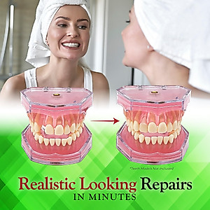 SmileFix Deluxe Dental Repair Kit - Color Matching Compound - Includes Tools - Missing Or Damaged Teeth - Fix Gaps, Broken Teeth - Durable Tooth Repair - Fast & Easy Process